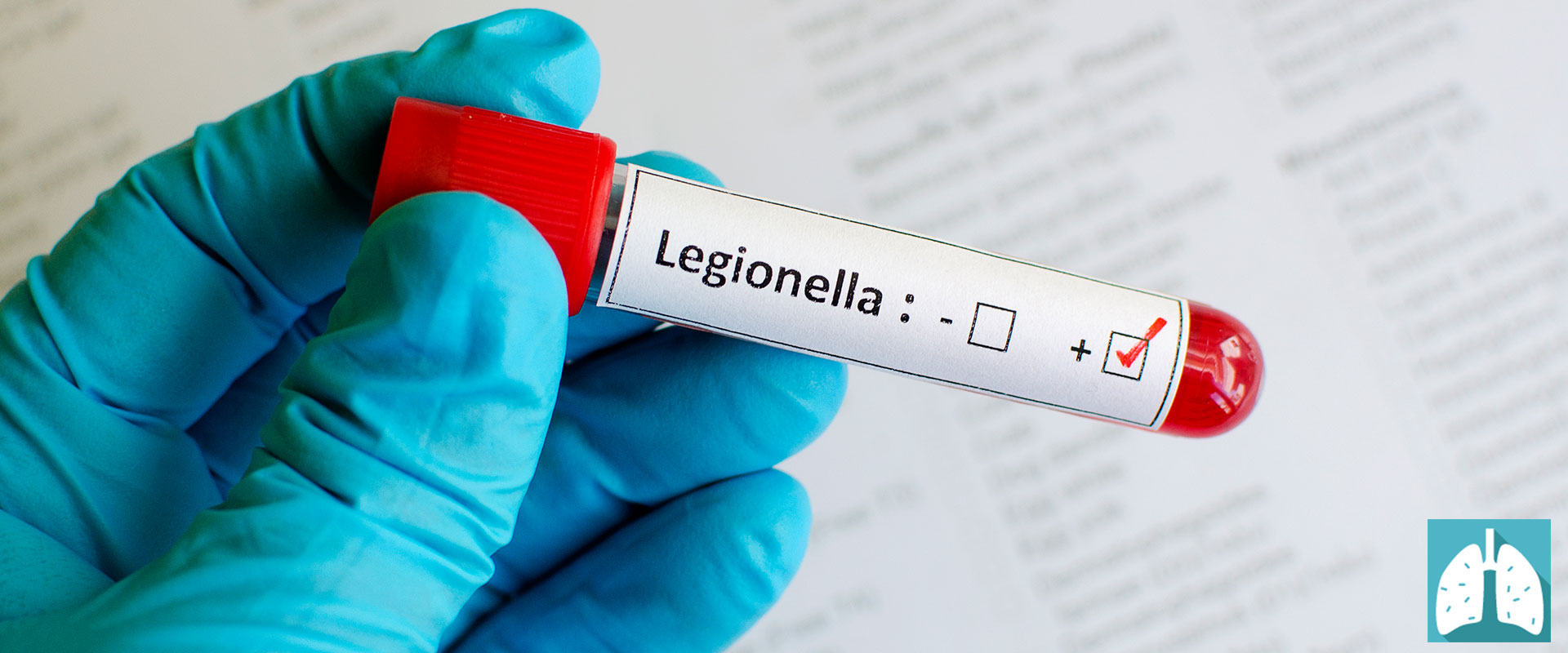 How and Why to Manage Legionella in the Workplace - Westminster